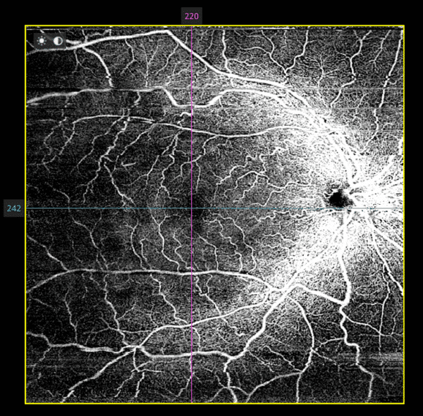 Privater Augenarzt Mannheim Oststadt | Dr. Auerbach